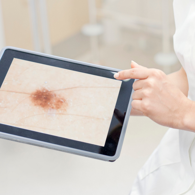Mole Mapping Screening Service at Grand Aura – Grand Aura Dermatology ...